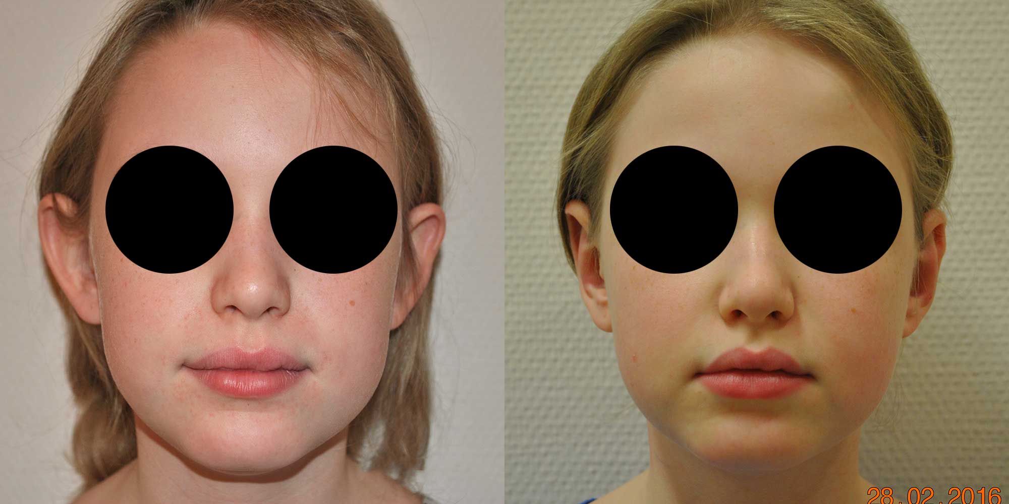 HNO Dr. Matthias Grabner - Ihr Spezialist für Nasenkorrektur ...