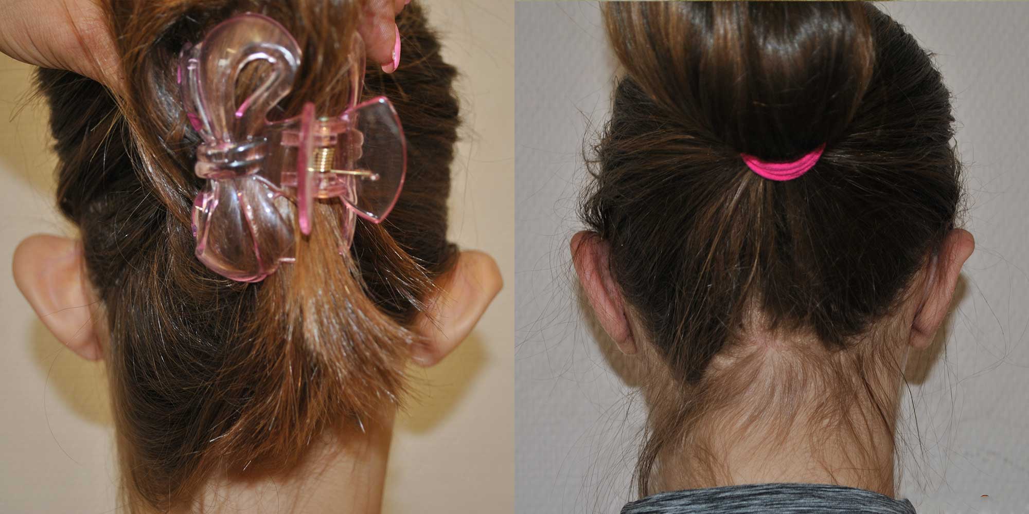 HNO Dr. Matthias Grabner - Ihr Spezialist für Nasenkorrektur ...